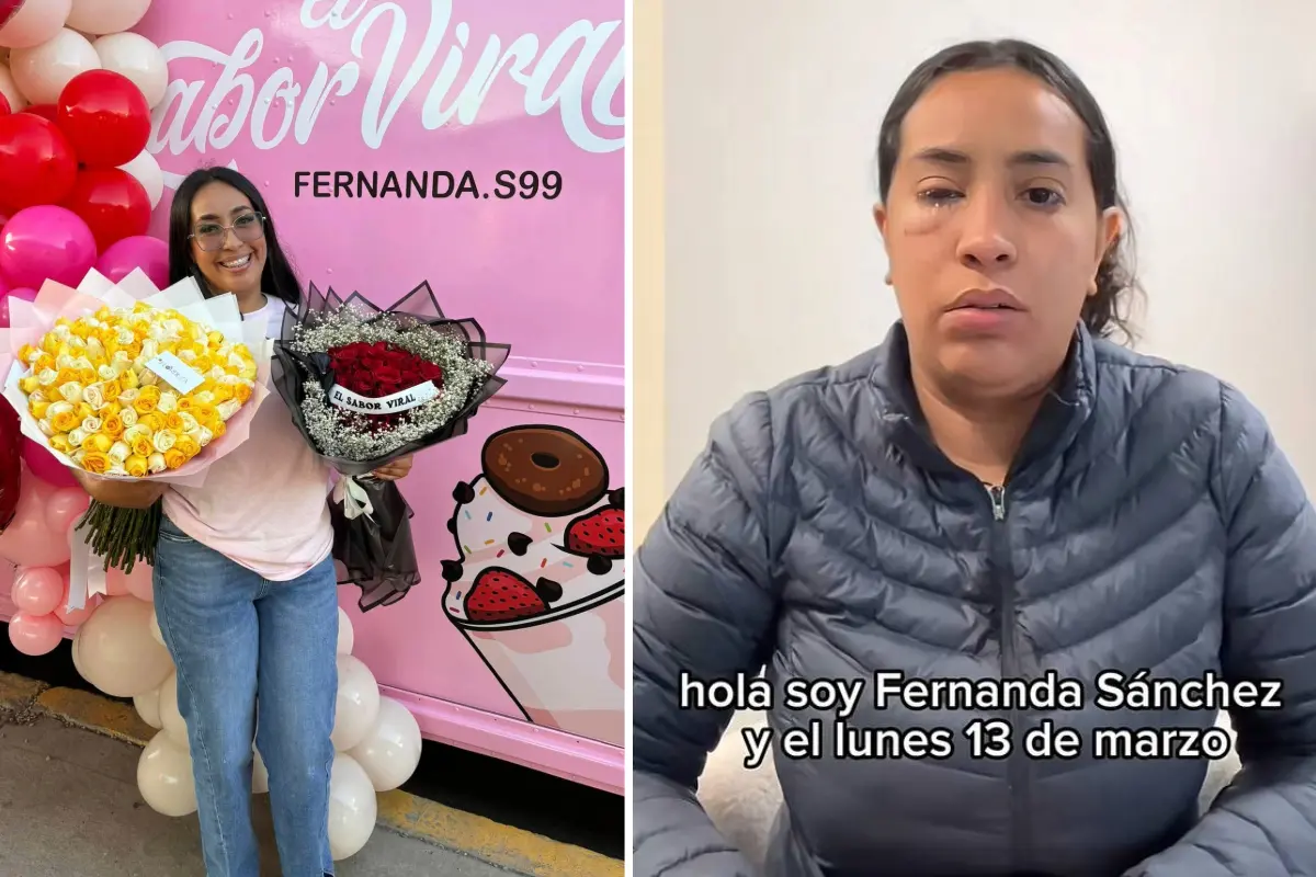 Fernanda Sánchez exige justicia tras ser ataca con ácido - Quinto Poder